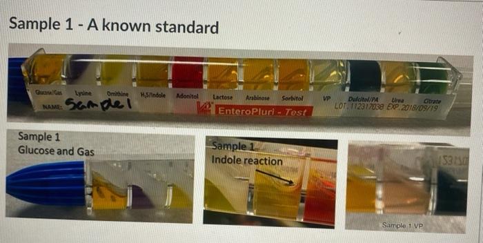 Solved Find code for sample in Enterotube These are the | Chegg.com
