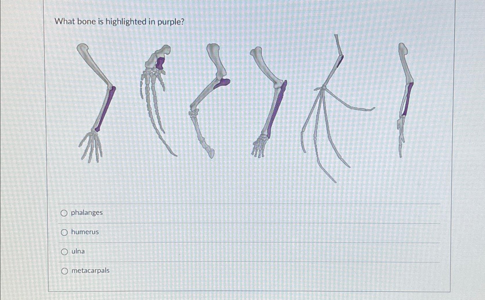 Solved What bone is highlighted in | Chegg.com