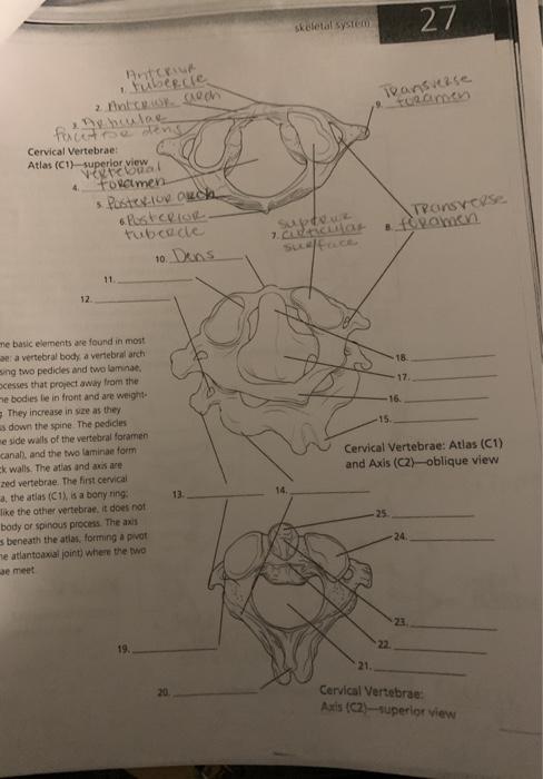 Solved 27 Teansverse tubercle 2 Into soch Avhuulag faceta | Chegg.com