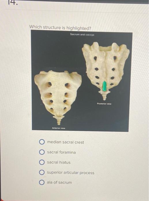 Solved 14. Which structure is highlighted? Sacram and coce O | Chegg.com