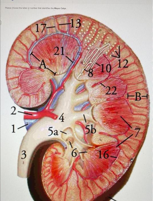 Solved Plechonetele number that on the Mayor Calyx 17–413 21 | Chegg.com