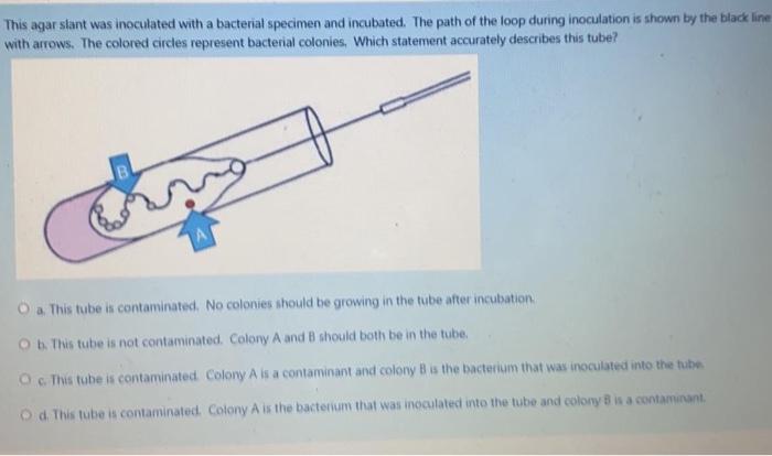 Solved This agar slant was inoculated with a bacterial | Chegg.com