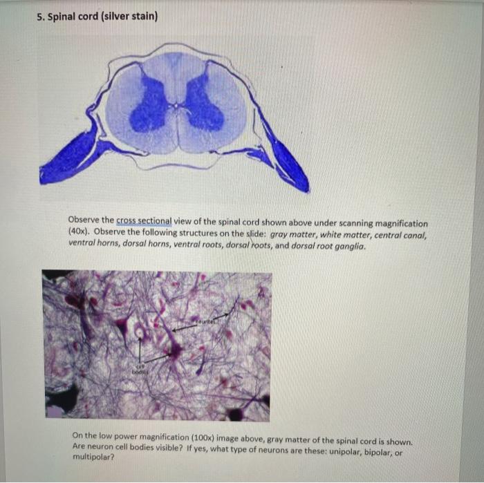 Solved 5. Spinal cord (silver stain) Observe the cross | Chegg.com