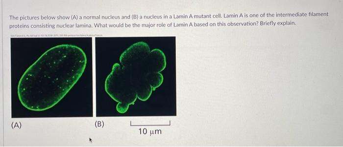 Solved The pictures below show (A) a normal nucleus and (B) | Chegg.com