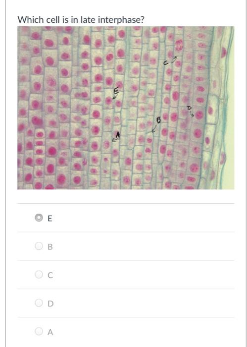 Solved Which cell is in late interphase? E B C D Ο Α | Chegg.com