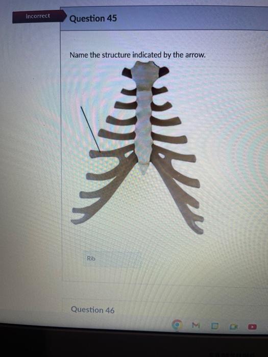 Solved Name the structure indicated by the arrow. | Chegg.com