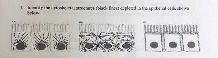 Solved 1- Identify the cytoskeletal structures (black lines) | Chegg.com