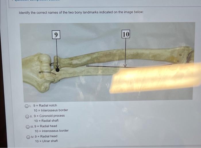 Solved Identify the correct names of the two bony landmarks | Chegg.com