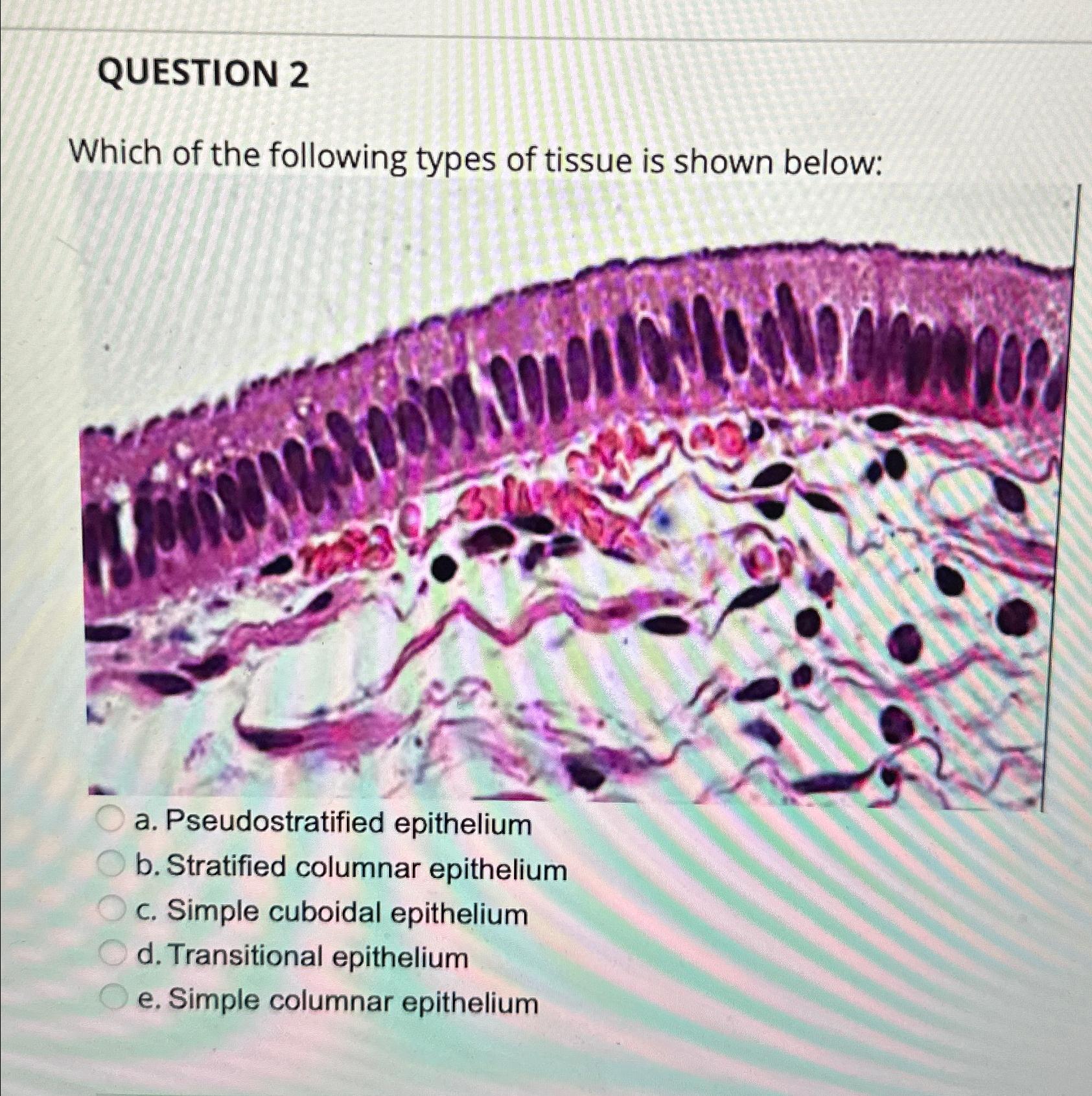 Solved QUESTION 2Which of the following types of tissue is | Chegg.com