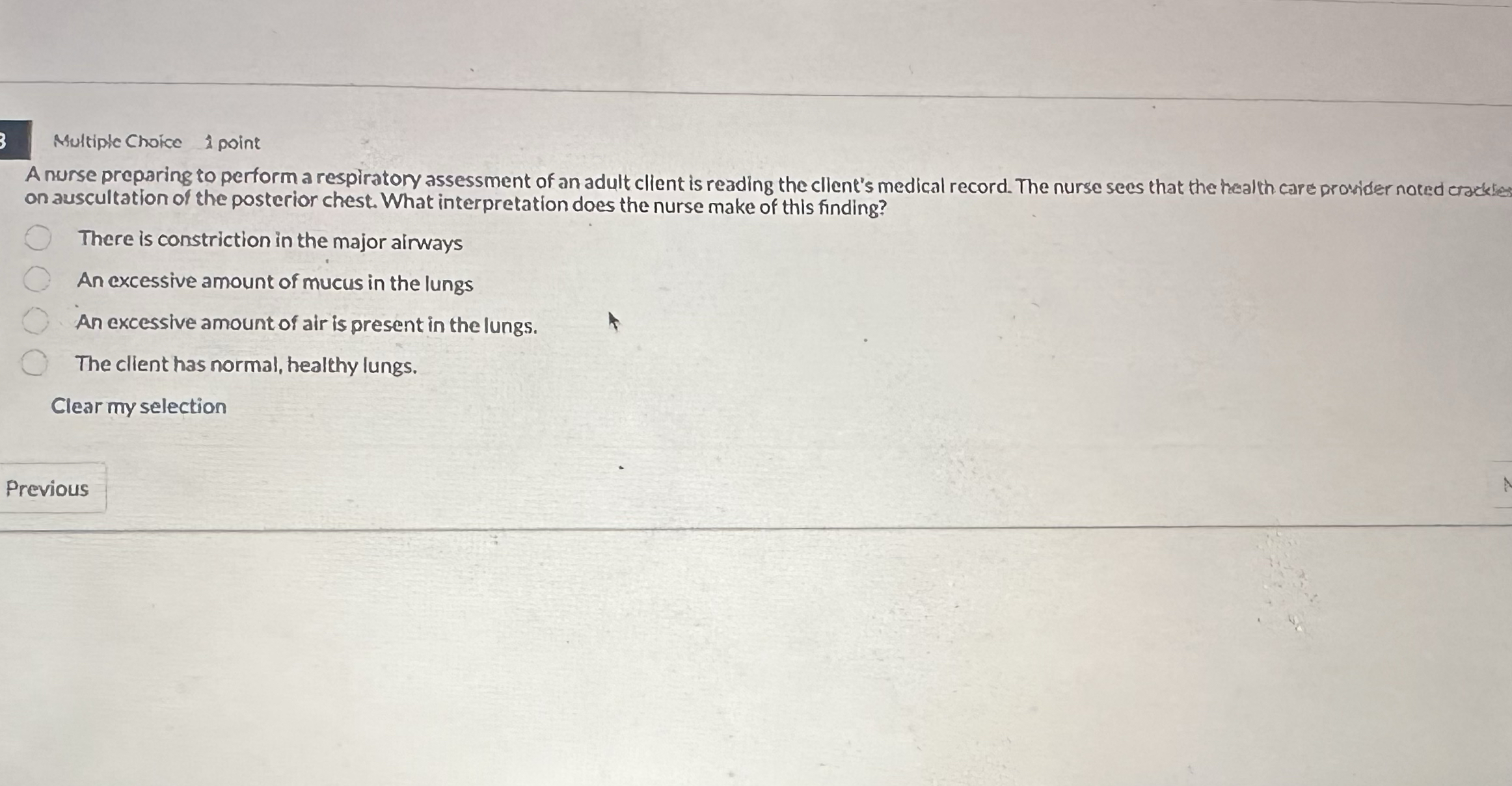 Solved Multiple Choice1 ﻿pointA nurse preparing to perform a | Chegg.com