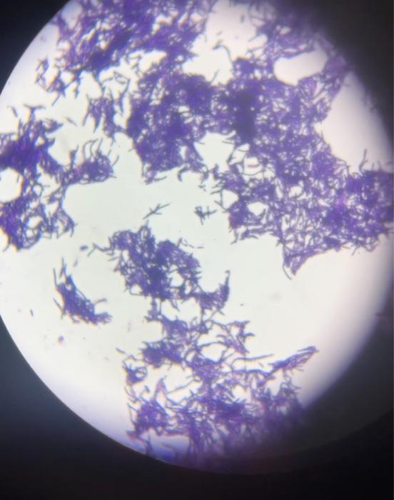 Solved any ideas on what my unknown bacteria looks like ? im | Chegg.com