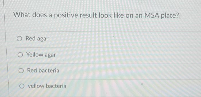Solved 1. what does EMB plate select four?2. what does a | Chegg.com