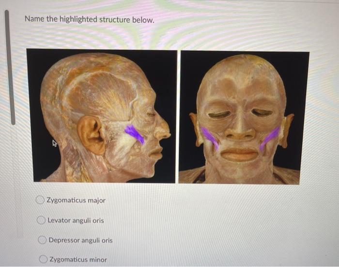 Solved Name the highlighted structure below. Orbicularis | Chegg.com