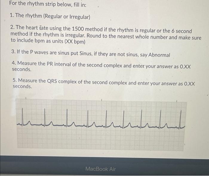 For the rhythm strip below, fill in: 1. The rhythm | Chegg.com