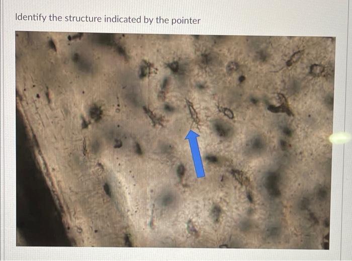 Solved Identify the structure indicated by the pointer | Chegg.com