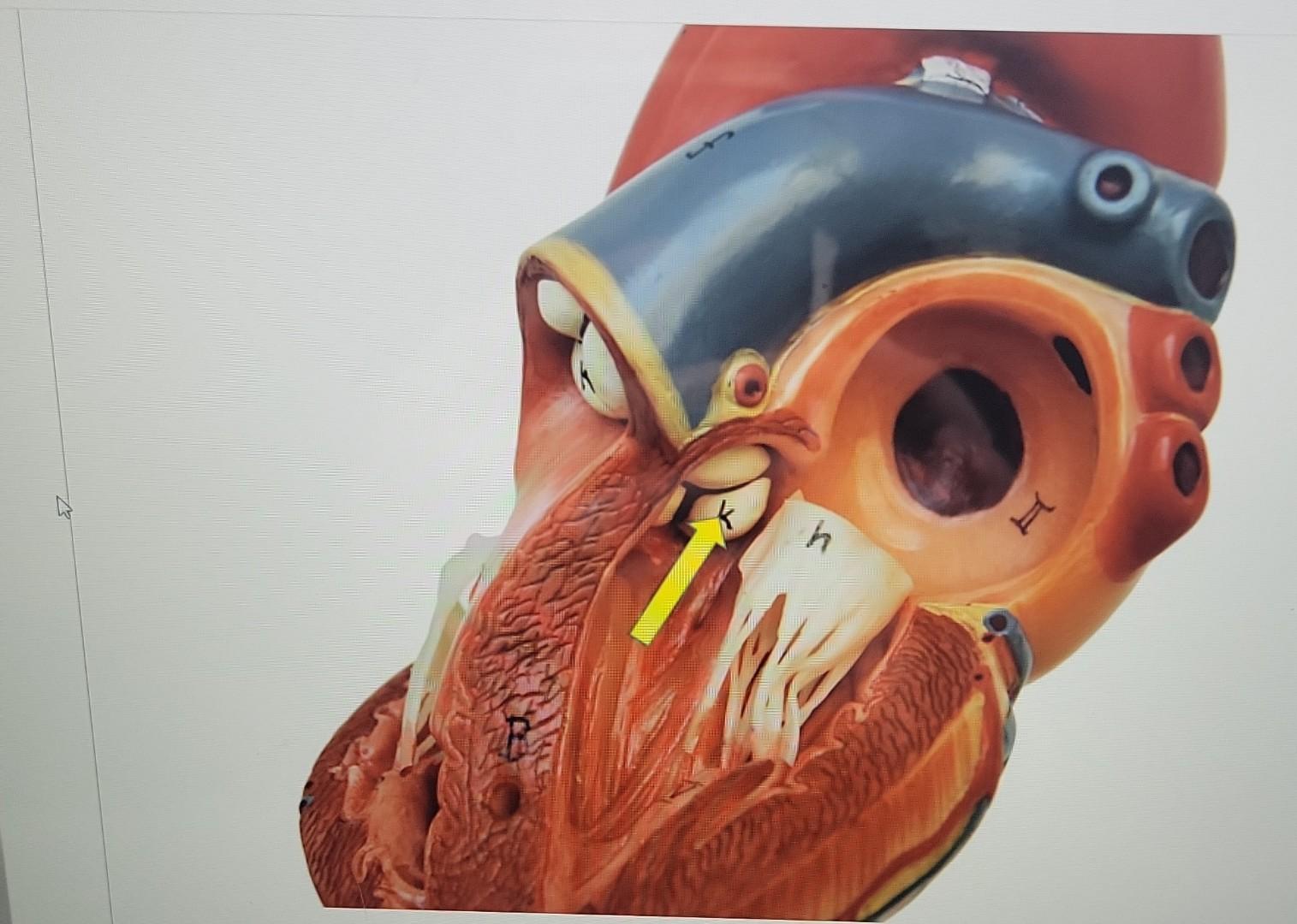 Solved dentify the structure at the tip of the | Chegg.com