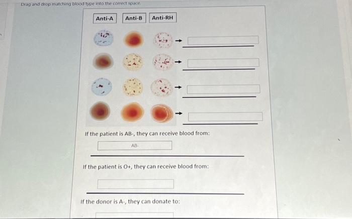 Solved Drag and drop matching blood type into the correct | Chegg.com