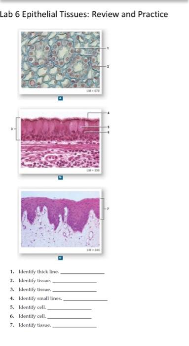 Solved Lab 6 Epithelial Tissues: Review and Practice LM00 | Chegg.com