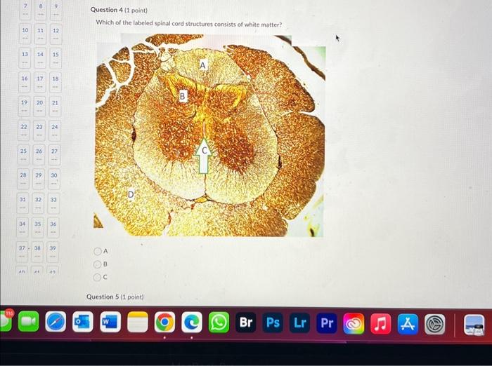 Solved Which of the labeled spinal cord structures consists | Chegg.com