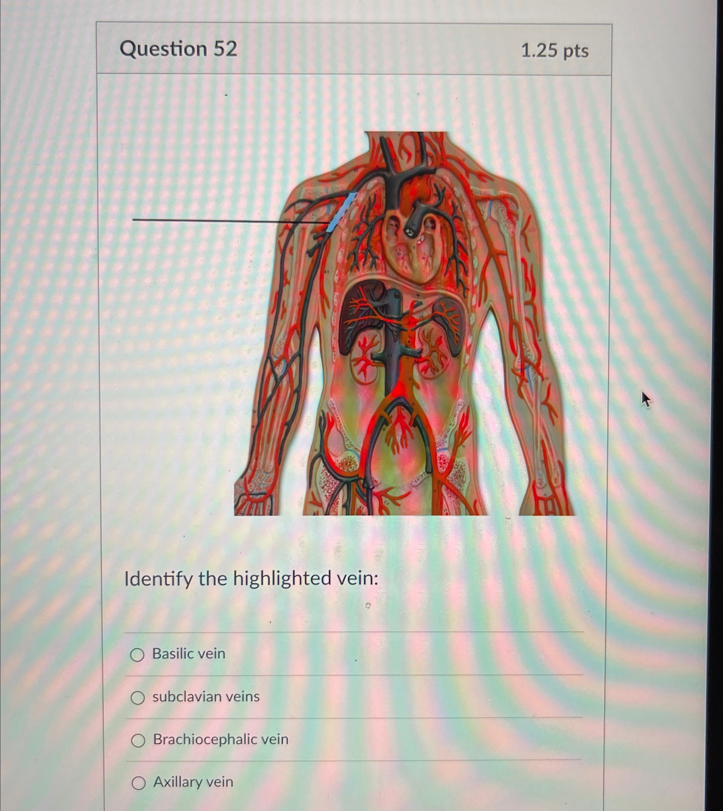 Solved Question 521.25 ﻿ptsIdentify the highlighted | Chegg.com