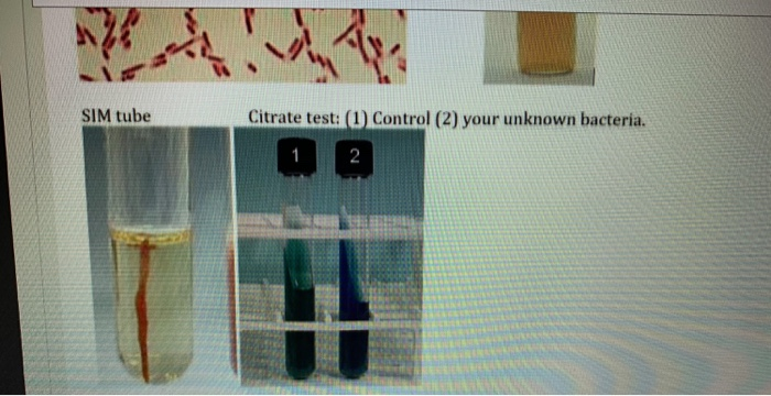 Solved SIM tube Citrate test: (1) Control (2) your unknown | Chegg.com