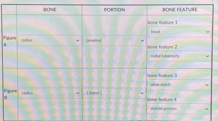 Label the upper limb bone \& portion | Chegg.com