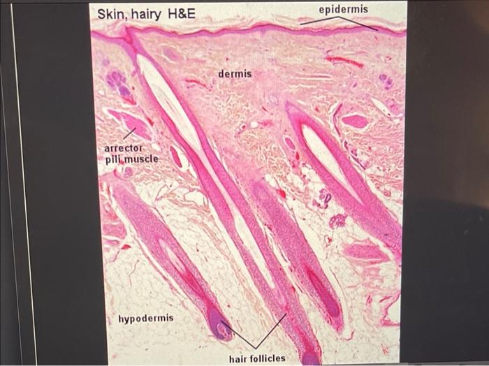 Solved question 1 - based off the think and thick skin | Chegg.com