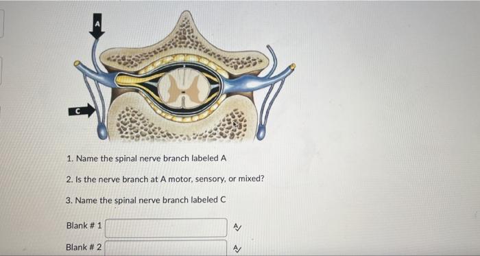 Solved J 1. Name the specific meninx (singular form of | Chegg.com