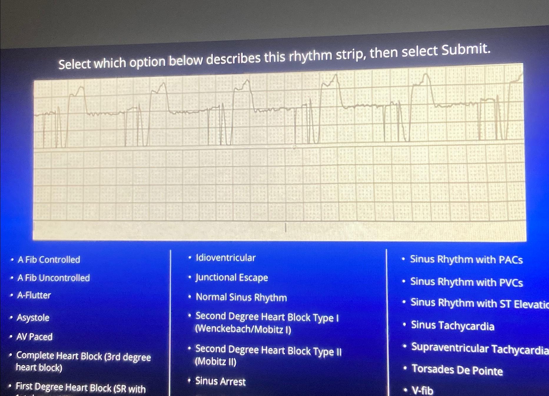 Select which option below describes this rhythm | Chegg.com