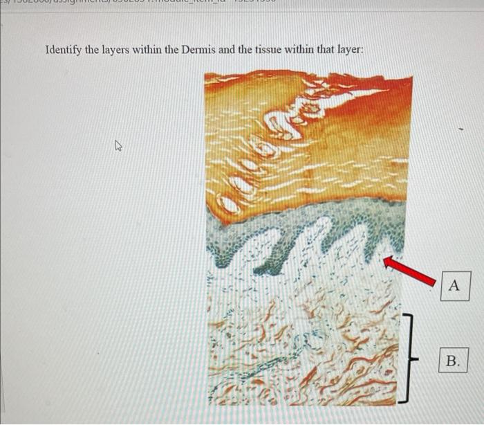 Solved Identify the layers within the Dermis and the tissue | Chegg.com Solved Identify the layers within the Dermis and the tissue | Chegg.com