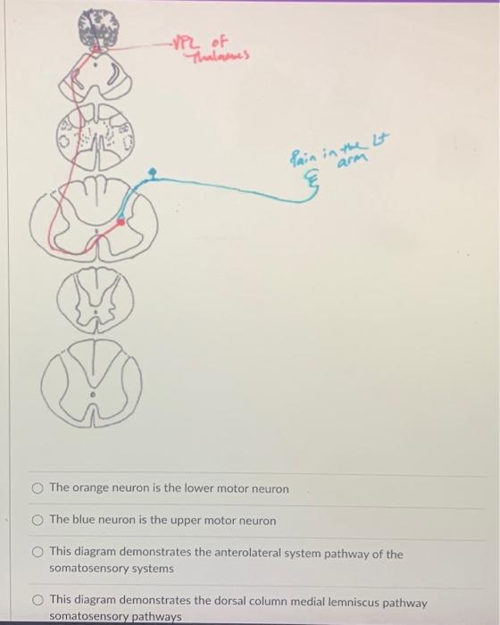 Solved The orange neuron is the lower motor neuron The blue | Chegg.com
