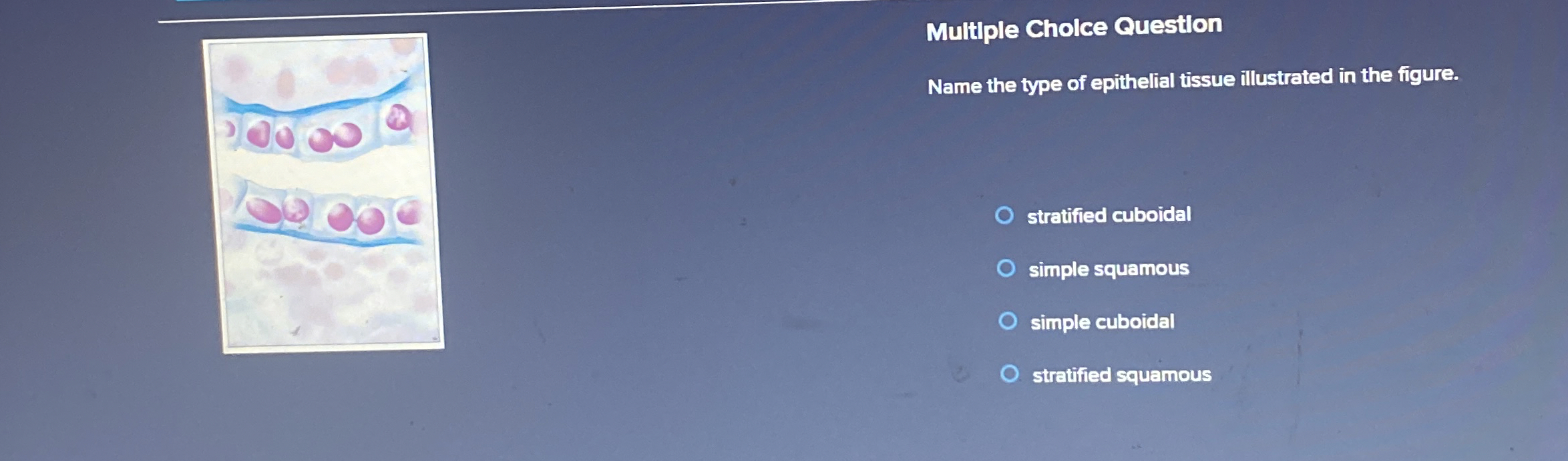 Solved Multiple Cholce QuestionName the type of epithelial | Chegg.com