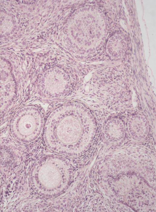Solved Identify the primordial follicle of the rabbit ovary | Chegg.com