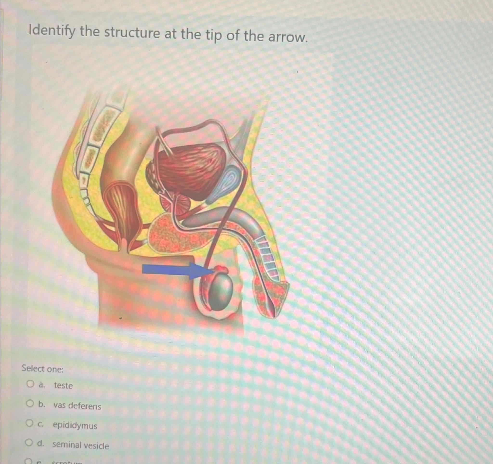 Identify the structure at the tip of the arrow.Select | Chegg.com