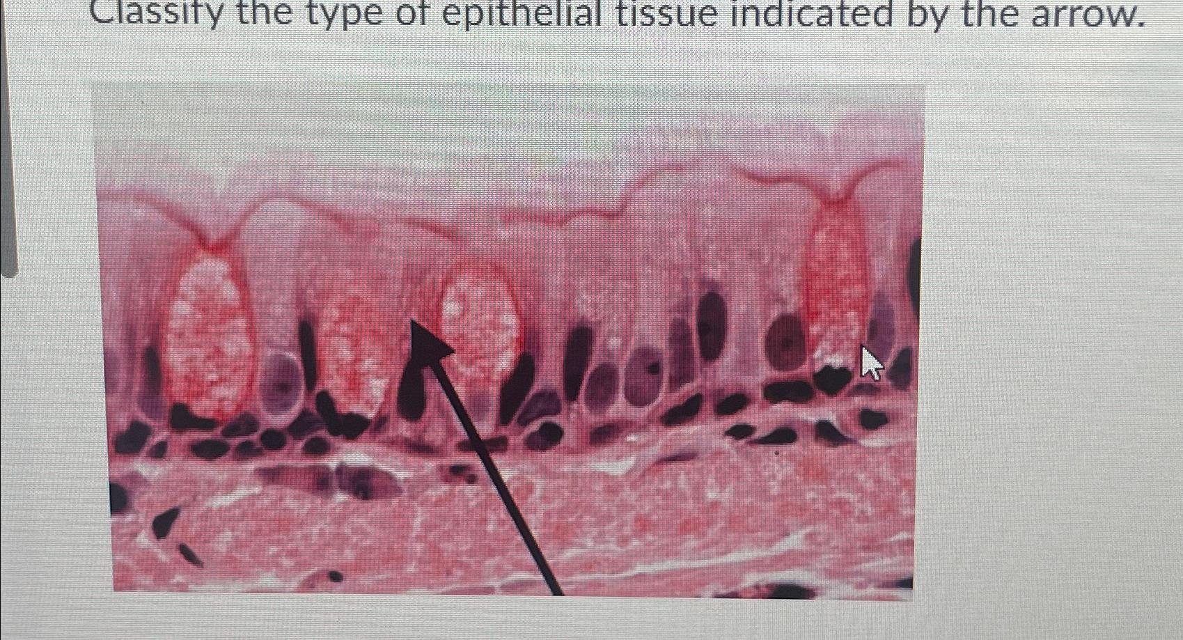 Solved Classity the type of epithelial tissue indicated by | Chegg.com