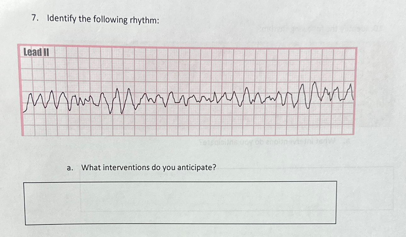 Identify the following rhythm:a. ﻿What interventions | Chegg.com