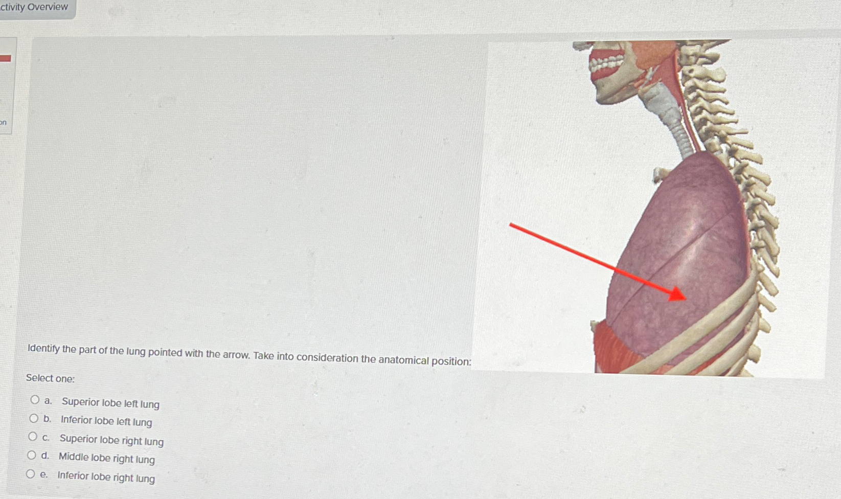 Solved Identify the part of the lung pointed with the arrow. | Chegg.com