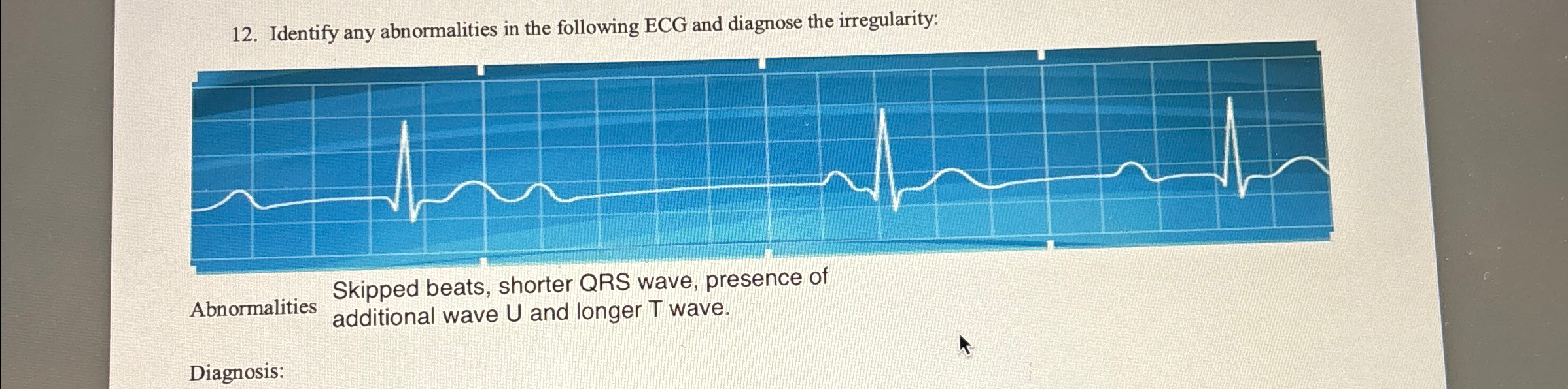 Solved Identify any abnormalities in the following ECG and | Chegg.com