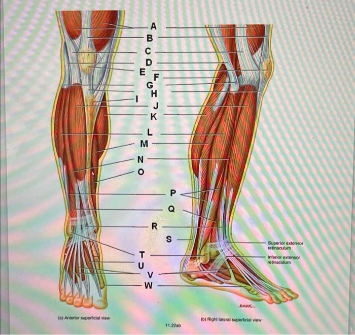 Solved A B C D E F צרפט M N Р 0 R S T U Superior extensor | Chegg.com