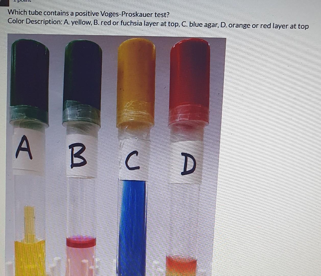 Solved Which tube contains a positive Voges-Proskauer test? | Chegg.com
