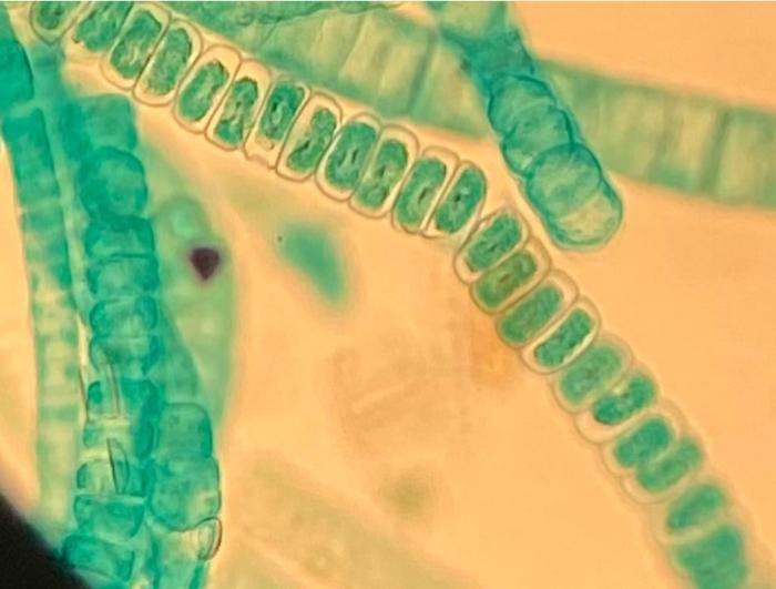 Solved spirogyra spiral shaped chloroplast abd pyrenoids. it | Chegg.com