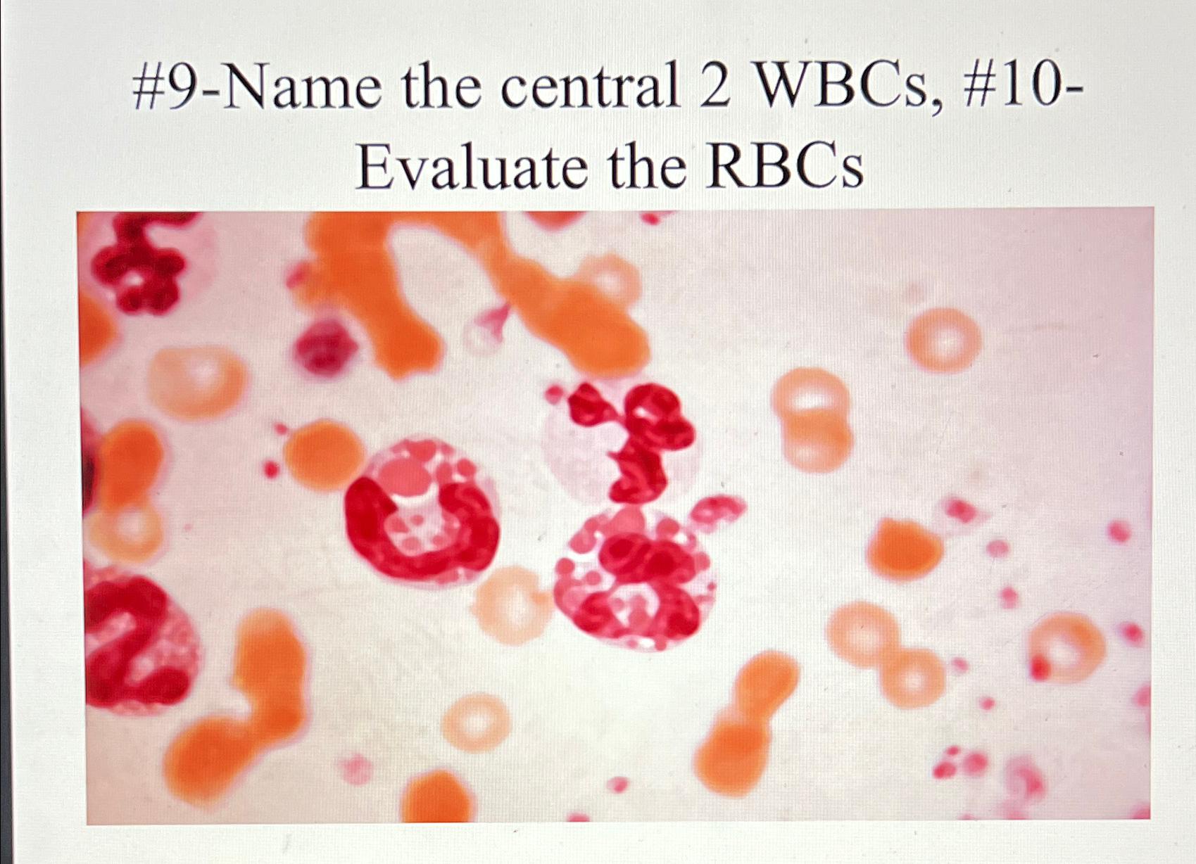 Solved #9-Name the central 2 ﻿WBCs, ﻿#10Evaluate the RBCs | Chegg.com