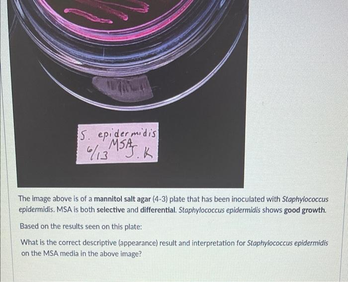Solved 5. epidermidis 6/3 MSAK S. epidermidis 6/13 MSAK | Chegg.com
