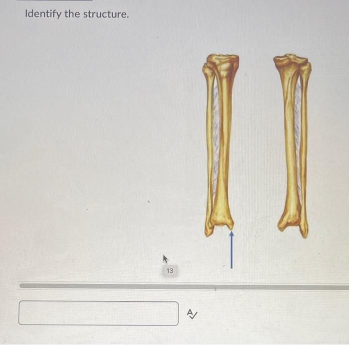 Solved Identify the structure. Identify this | Chegg.com