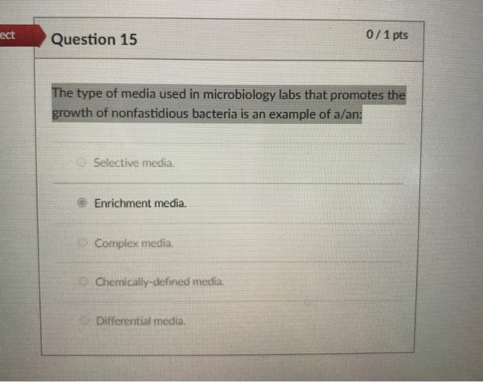Solved ect Question 15 0/1 pts The type of media used in | Chegg.com