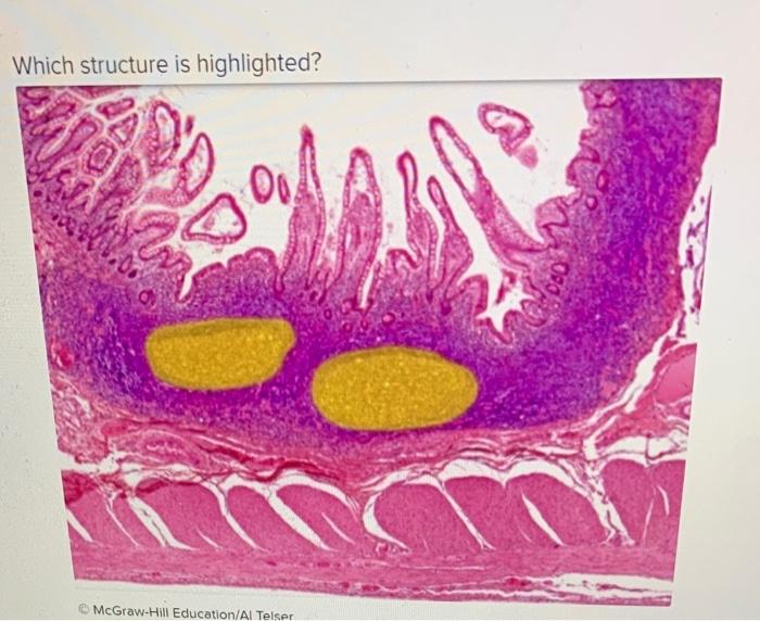 Solved Which structure is highlighted? On McGraw-Hill | Chegg.com