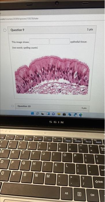 Solved This image shows epithelial tissue. (two words; | Chegg.com