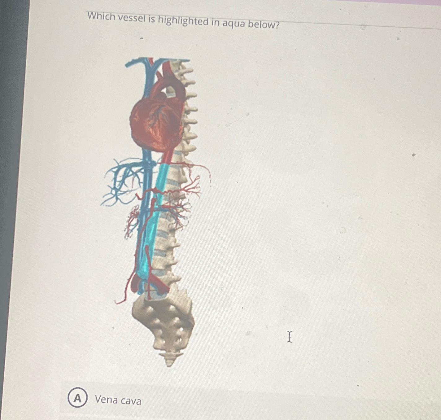 Solved Which vessel is highlighted in aqua below?ЄVena cava | Chegg.com