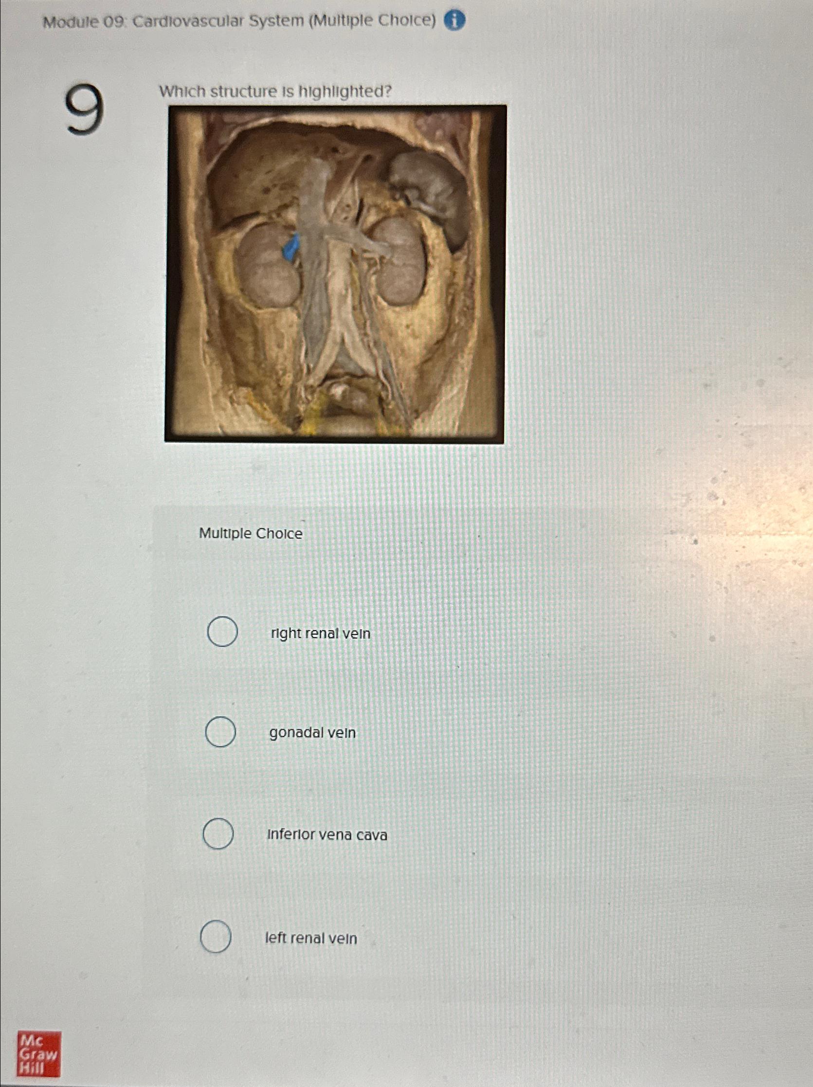 Solved Module 09: Cardiovascular System (Multiple | Chegg.com
