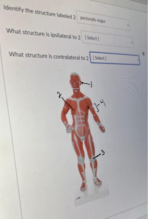 Solved Identify the structure labeled 2 What structure is | Chegg.com